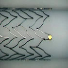 Bradenton Cardiology Center is First Site in the U.S. to Implant the ...